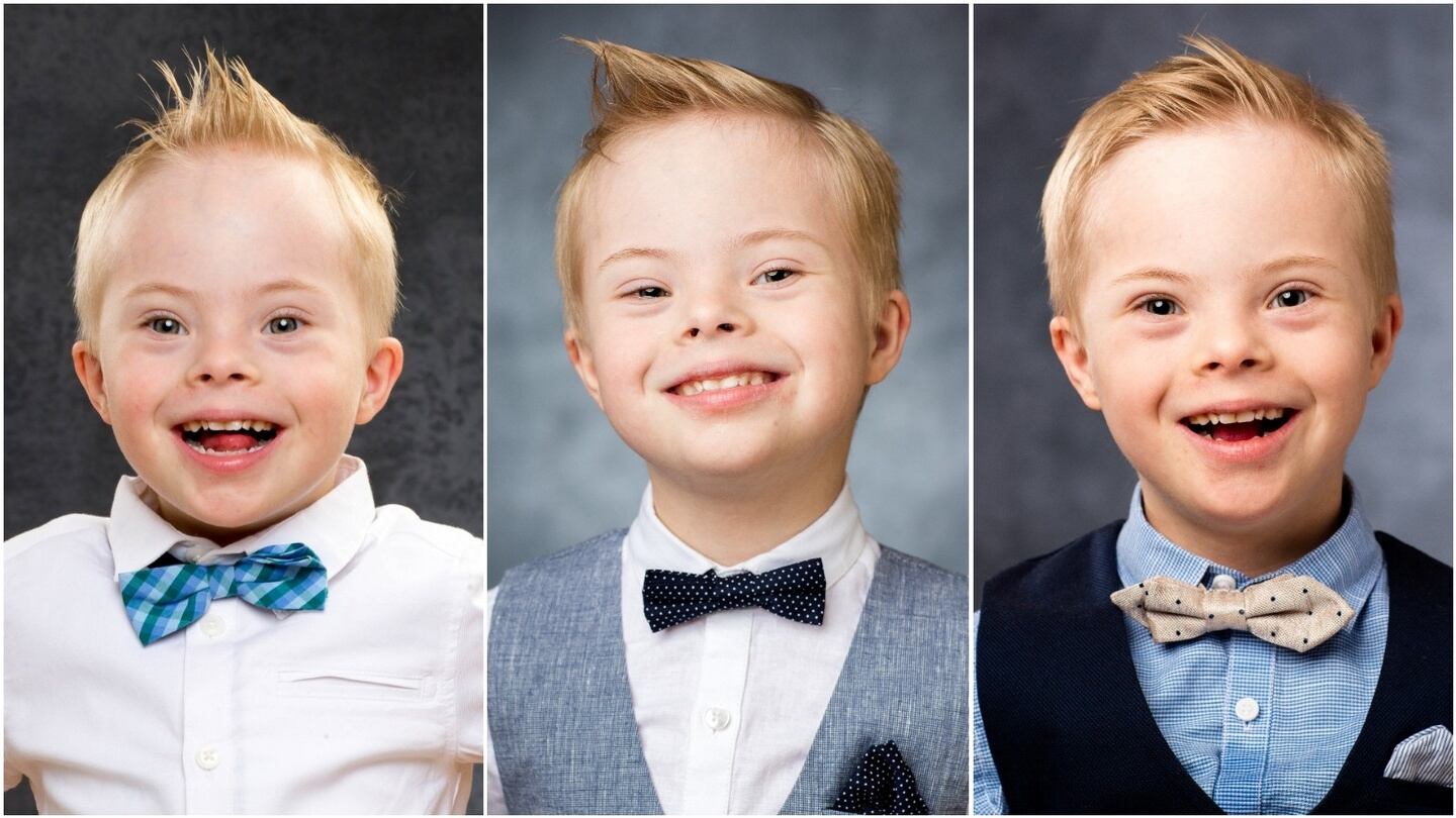 63 photographs, 47 chromosomes, 21 children – what do you see? – The ...