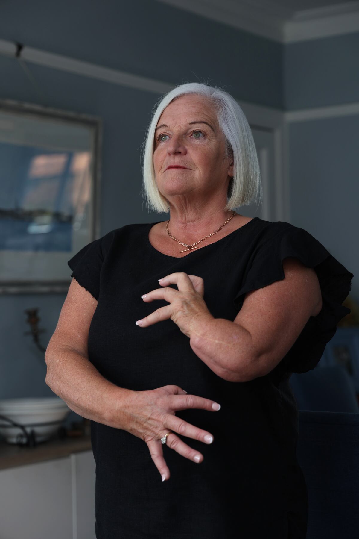 Thalidomide survivors: ‘Having no arms is an unusual disability, there ...